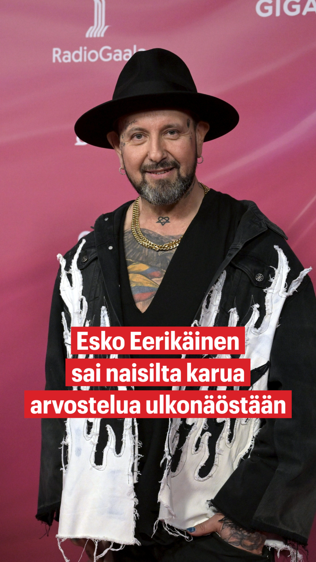 Miten nopeasti Esko Eerikäinen palautui yläluomileikkauksesta? - Ilta ...